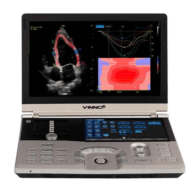 Ultrasonido portátil VINNO 6: La solución compacta para diagnósticos ...